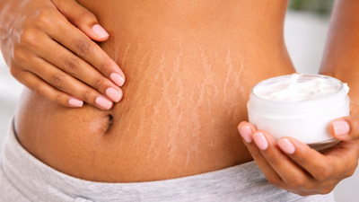 Cómo elegir la mejor crema antiestrías para tu piel – 5punto5